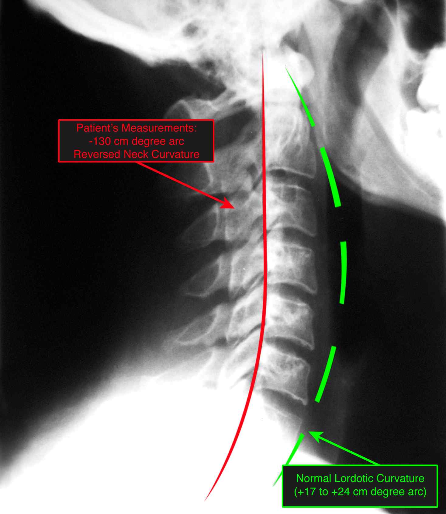 Case Studies - Dr. Marink's Sleep Pillows