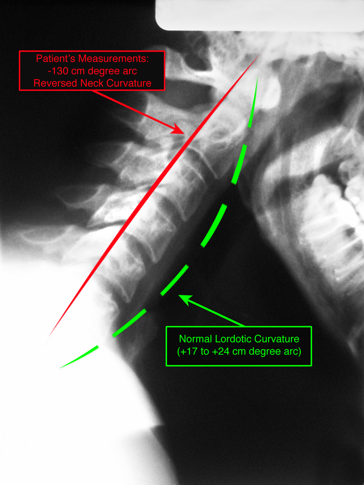 Case Studies - Dr. Marink's Sleep Pillows